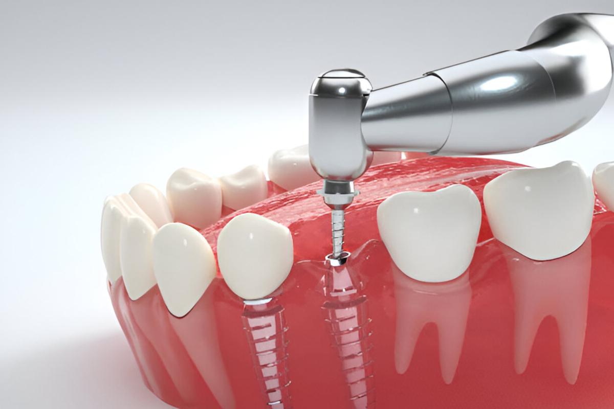 Dr. Karve's Dentech: Thane's Smile Wizards at Your Service