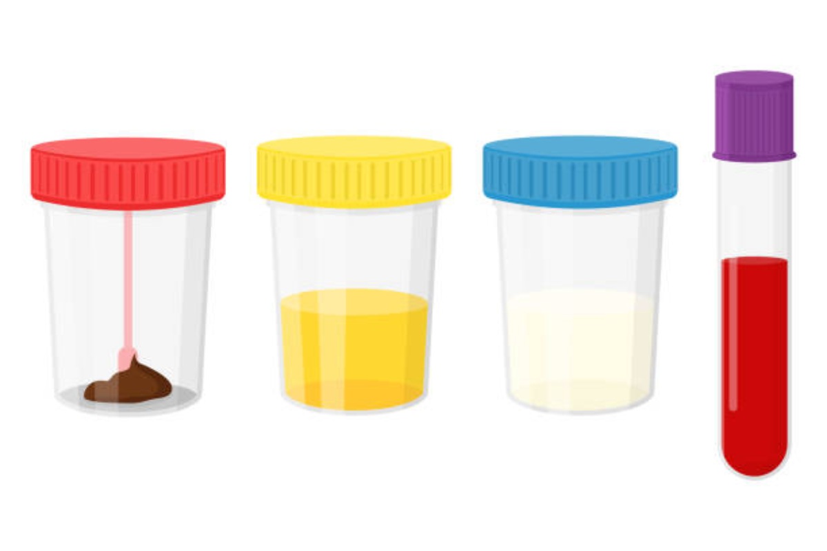 Normal Sperm Color Chart: Interpretations & Health Tips