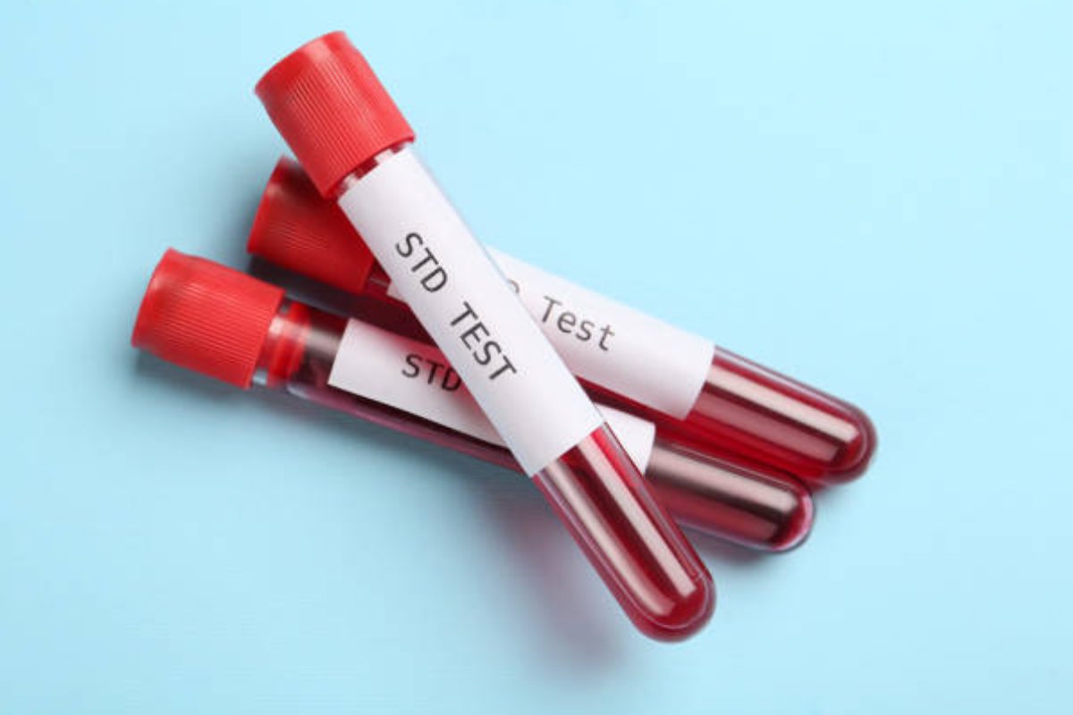 How to Talk to Your Partner About STD Testing